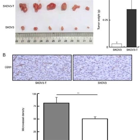 Sp1‑knockdown Inhibits The Tumor Growth And Angiogenesis Of Skov3‑t
