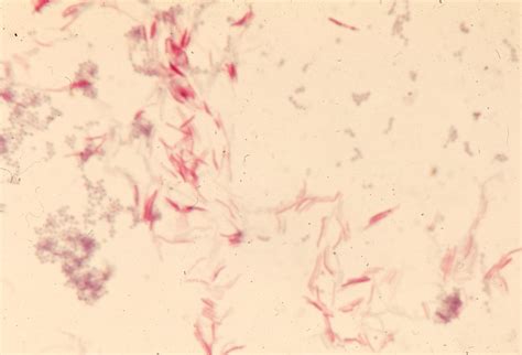 Mycobacterium Smegmatis Gram Stain