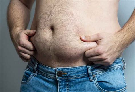 Elimina Flacidez Abdominalman Medical Institutemedicina Estética