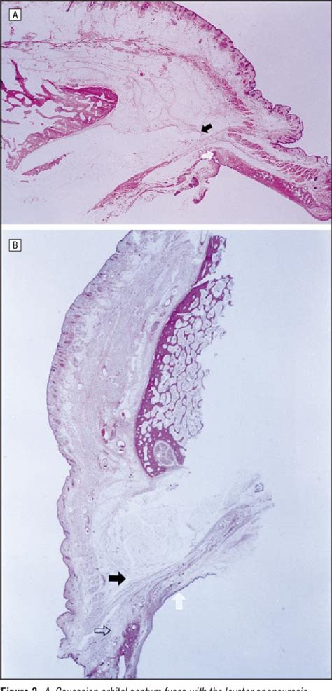 Skin Structure Of Eyelid Semantic Scholar