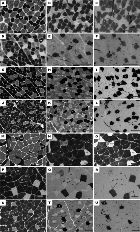 Photomicrographs Of Muscle Fragments Processed By The Matpase Reaction