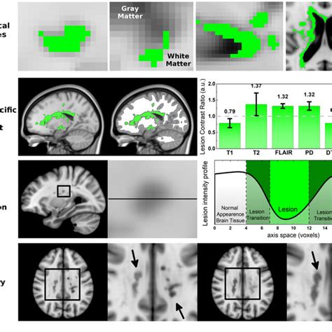Lesion Modeling Used In The Entire Simulation Process Lesion Download Scientific Diagram