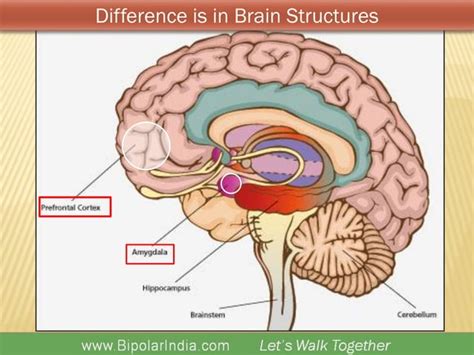 Bipolar Disorder Demystifying A Serious Mental Illness Ppt