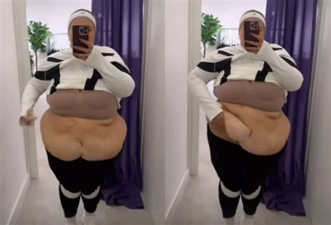 Thais Carla Relata Desafio Do Excesso De Pele Após Perder Mais De 50 Kg
