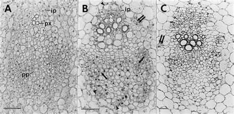 Vascular Bundle In Root