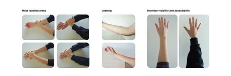 Prosthetic Socket Redesign On Behance