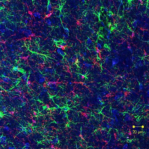 Parkinsons Disease Linked To Microbiome Medical Engineering