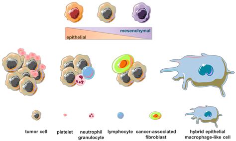 Cancers Free Full Text Signatures Of Breast Cancer Progression In