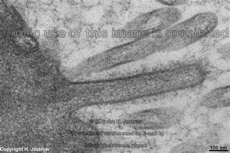 Glycocalix Drjastrows Electron Microscopic Atlas