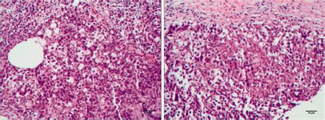 Representative Photomicrographs Showing The Histological Features Of A