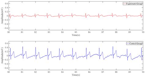 Sensors Free Full Text Single Position Ecg Detection System Based