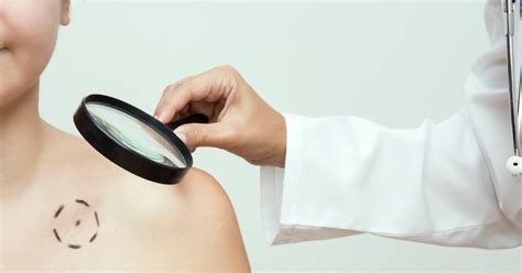 Learn How Skinio Enhances Skin Cancer Screenings Bdh