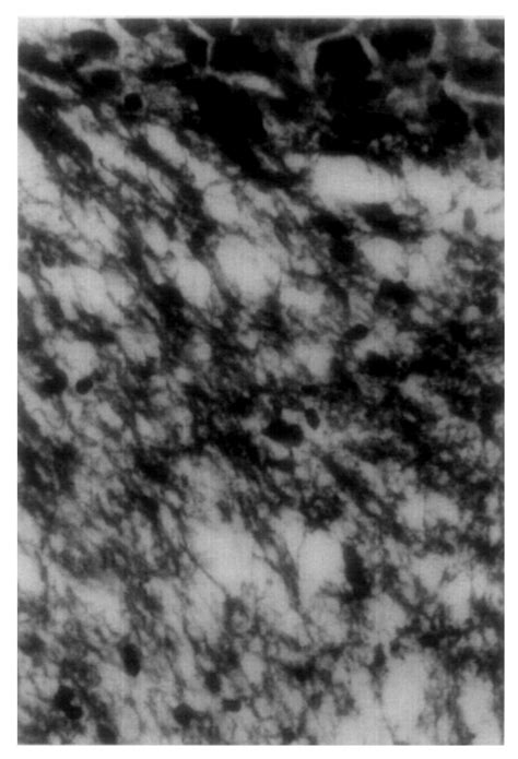 Optic Tract In The Area Of The Supraoptic Nucleus In An Hcp Treated