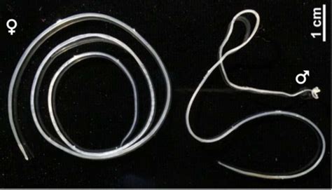 Parasitology Nematode Lab Images Flashcards Quizlet