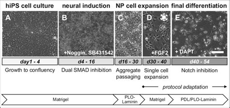 Process Overview Neuronal Differentiation Of Hips Cells The Neuronal