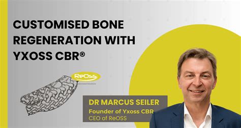 Yxoss Cbr Customised Bone Regeneration Course Dental Iceberg