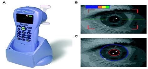 Evaluation Of The Portable Infrared Pupillometer Neurosurgery