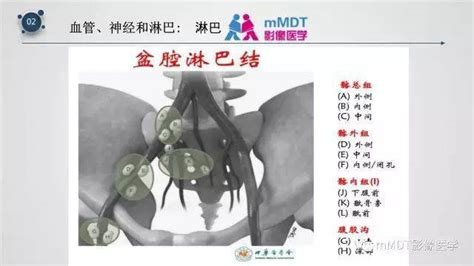 子宫附件影像解剖黄体
