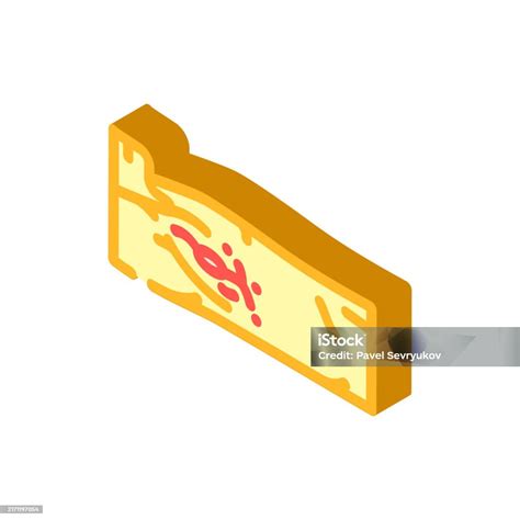 Lymph Node Dissection Surgery Isometric Icon Vector Illustration Stock