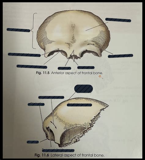 Anatomy Of The Frontal Bone Key Landmarks And Features Diagram Quizlet