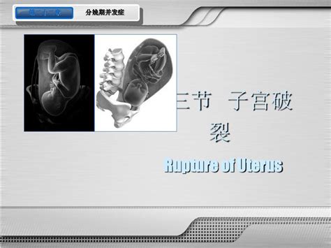 子宫破裂 Microsoft Powerpoint 演示文稿 2word文档在线阅读与下载无忧文档