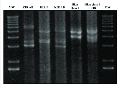 Preimplantation High Resolution Hla Sequencing Using Next 52 Off