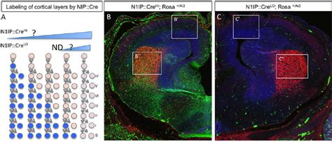 Notch1 Cre Activity In Neuronal Precursors Coronal Sections Through