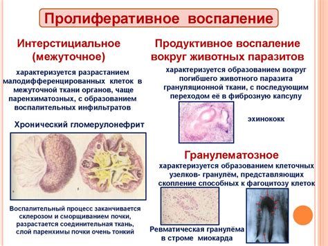 Воспаление - презентация онлайн