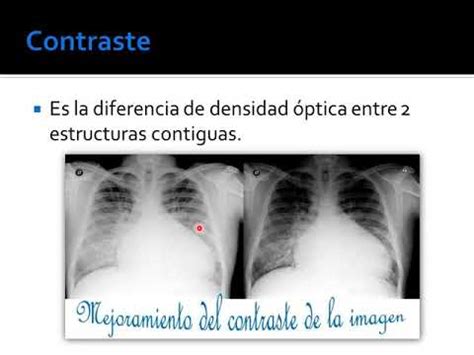 Calidad Radiologica Rx Tv YouTube