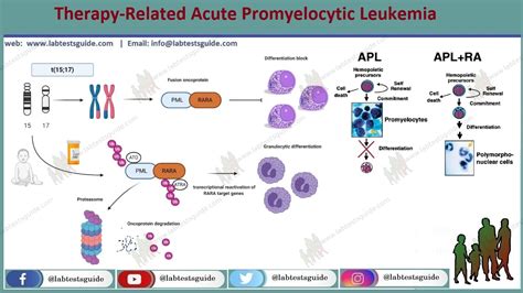 Leukemia Causes Lab Tests Guide