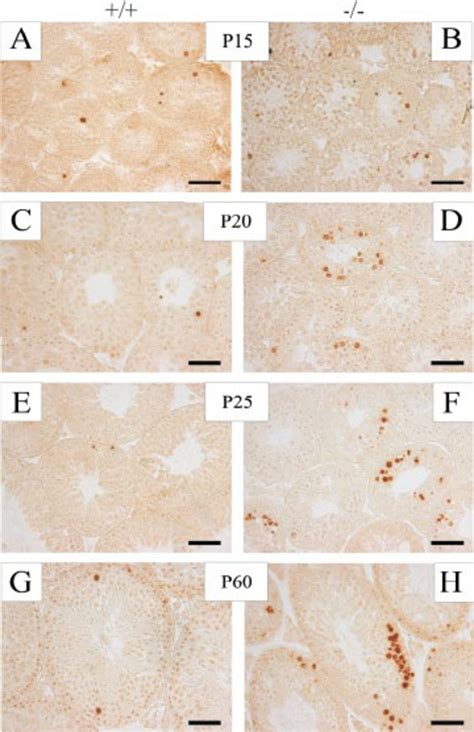 Apoptosis Is Increased In Germ Cells During The First Wave Of