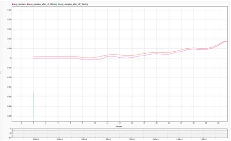 Fft ECG Analysis In MATLAB Signal Processing Stack Exchange
