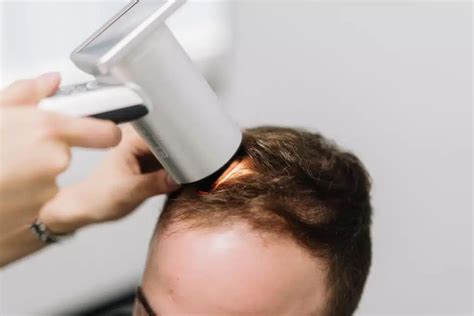 Thorough Hair Analysis In Sydney Hair Doctors