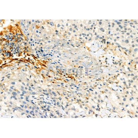 Ar Beta3 Antibody Affinity Biosciences Ltd 亲科生物官网