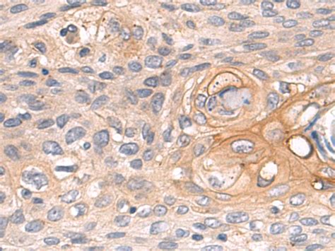兔抗parp4多克隆抗体anti Parp4 Rabbit Polyclonal Antibody 生命科学产品与技术服务 生工生物工程