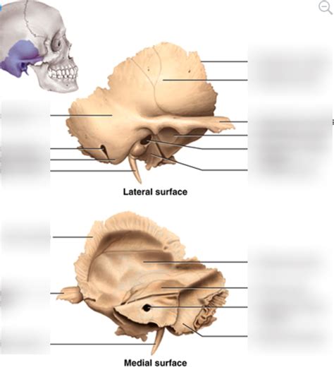 Temporal Bone Diagram Quizlet