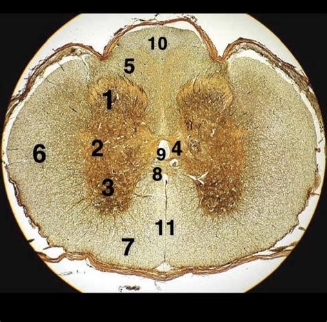 Lab Exam Flashcards Quizlet
