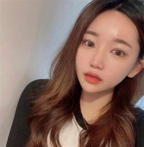 양악수술 비용 및 양악수술 전후 후기 비교 네이버 블로그