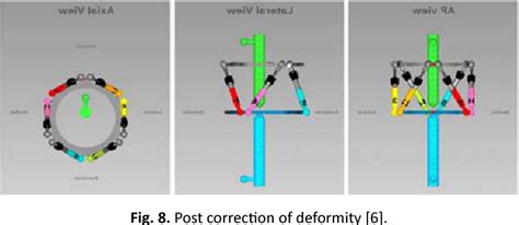 Figure 2 From Orthoplastic Consideration During Distal Tibia Deformity