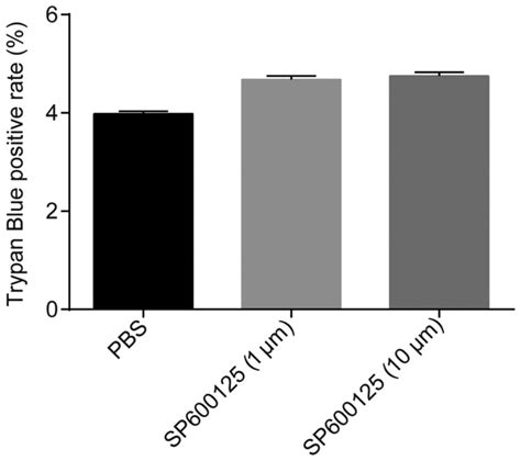 Downregulated Lrrk2 Gene Expression Inhibits Proliferation And