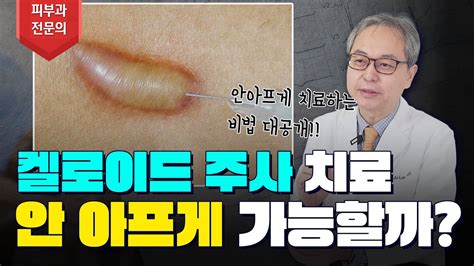 켈로이드 주사 통증 확 줄이는 비법 大공개 Youtube
