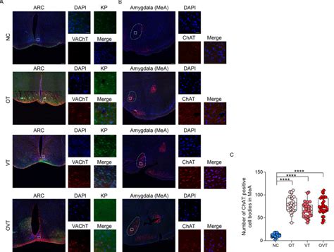 Early Exposure Of An Infantile Rat To Sex Related Content Induces