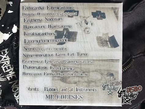 Hypocalciuric Hypercalcemia Medical Teratocarcinoma Anus Last Distro Of Humanity