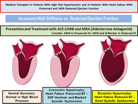 Ejection Fraction Heart