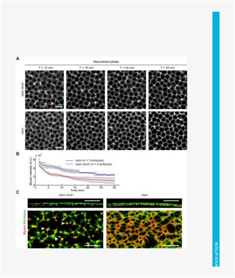 Projections Of Confocal Sections Showing Sqh Gfp At Graphics