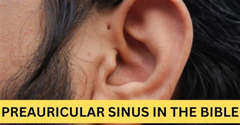 What Is The Significance Of Preauricular Sinus In The Bible