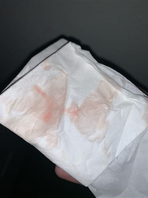 Is 13 14 Dpo Too Late For Implantation Bleeding Glow Community