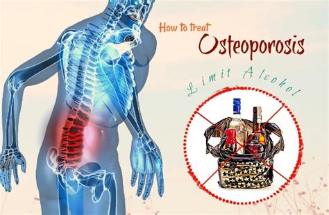 33 Tips How To Treat Osteoporosis Pain Of The Hip Knee Spine Naturally