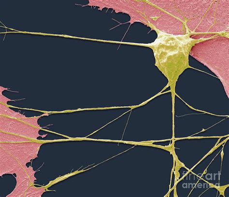 Stem Cell Derived Motor Neuron Photograph By Steve Gschmeissner Science