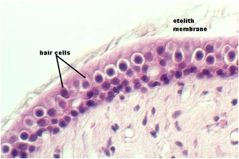 Otoliths Histology